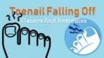 Why Are My Toenails Falling Off: Causes, Care, Prevention