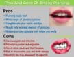 Smiley Piercing: Infection, Pain, Healing, Risks, Jewelry