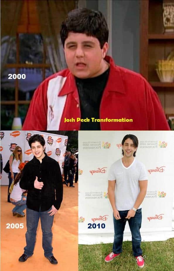 Josh Peck Before And After Josh Peck Before And After