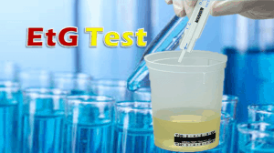EtG Test | Pros And Cons Of This Urine Alcohol Test Revealed